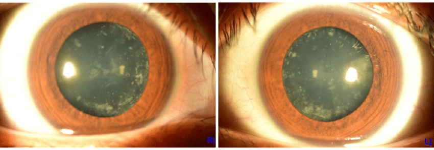 Makanta | Bakandamiya